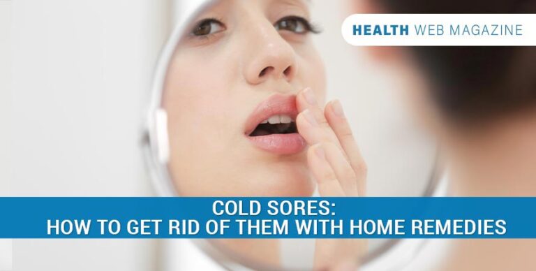 How To Get Rid Of Cold Sores Fast: Try These 8 Remedies