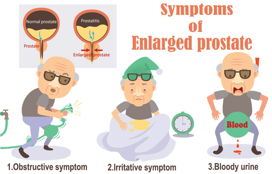 Sexual Concerns Does An Enlarged Prostate Affects Man Sexually