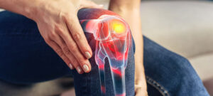 Synovitis Knee: Causes, Prevention, and Possible Treatment!