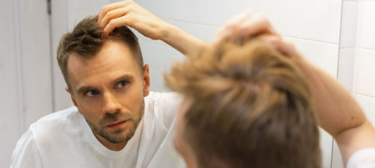 Watch out for these Early Signs of Balding